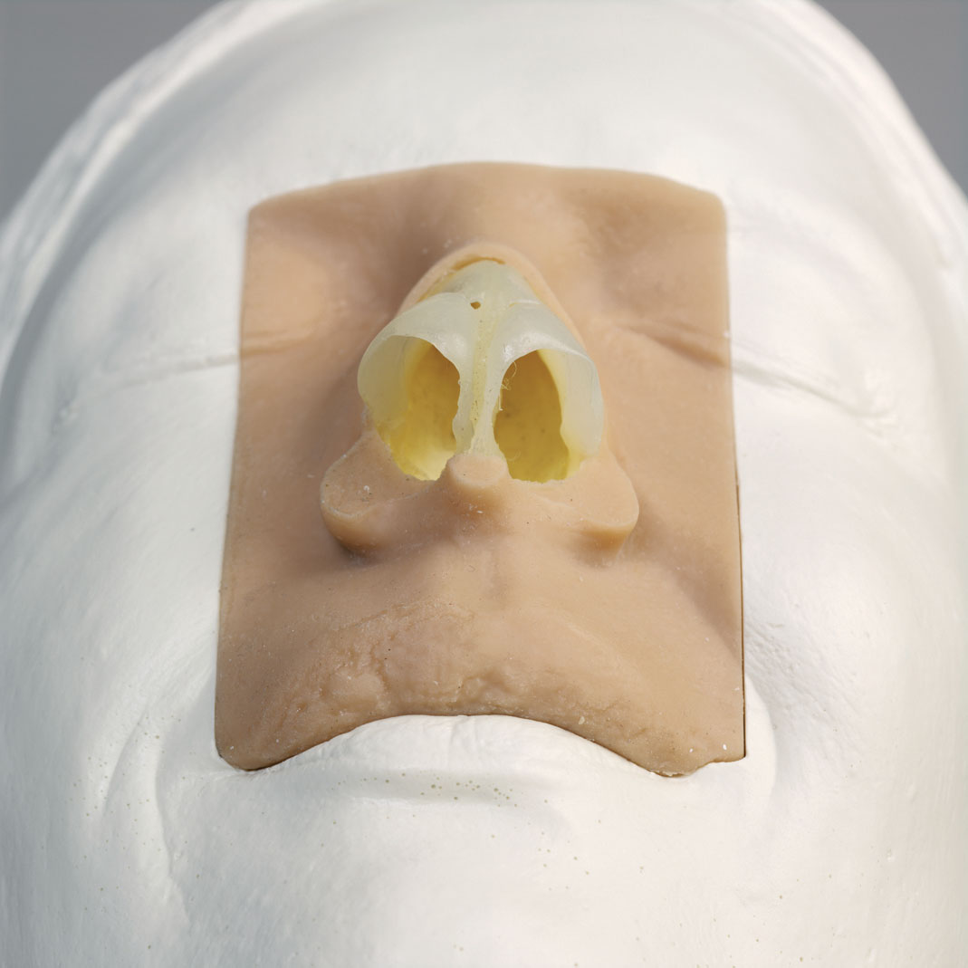 Rhinoplasty Model | Adam Rouilly