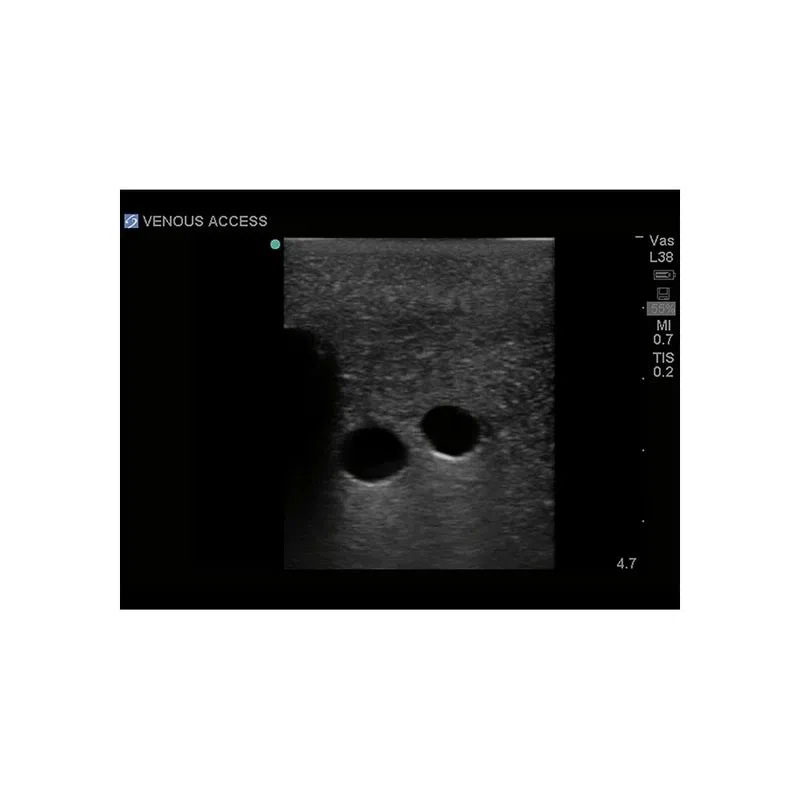 Gen II Central Line & Regional Anaesthesia Ultrasound Training Model ...