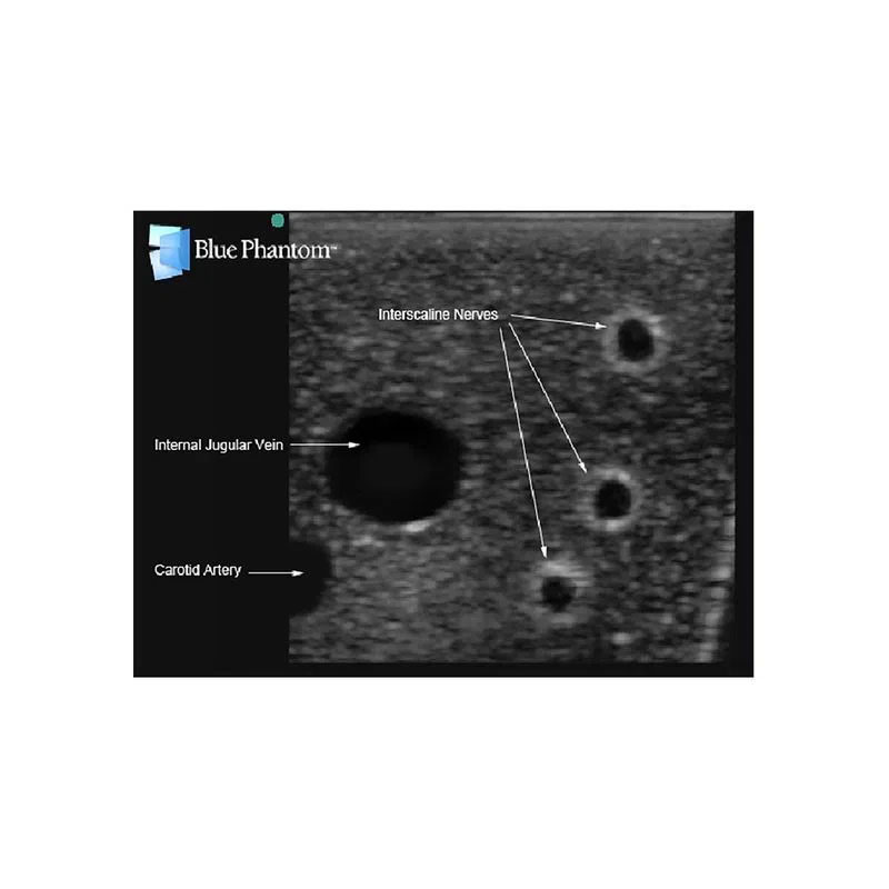 Gen II Central Line & Regional Anaesthesia Ultrasound Training Model ...