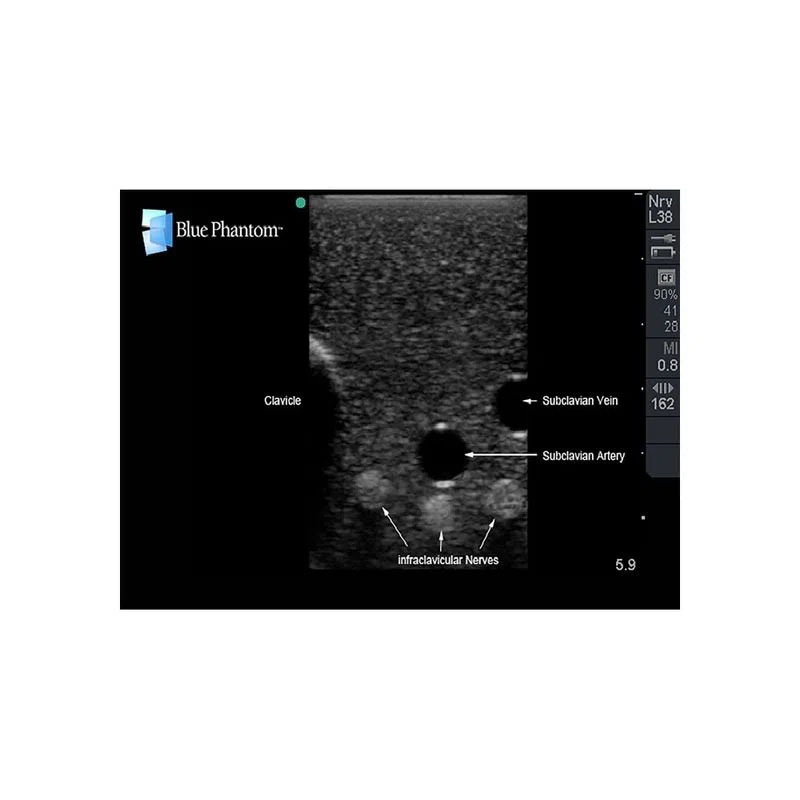 Gen II Central Line & Regional Anaesthesia Ultrasound Training Model ...