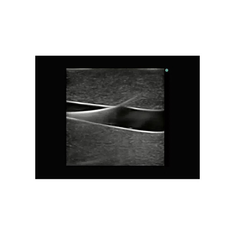 Leg Model With Femoral & Saphenous Vein Venous Access for Ultrasound ...