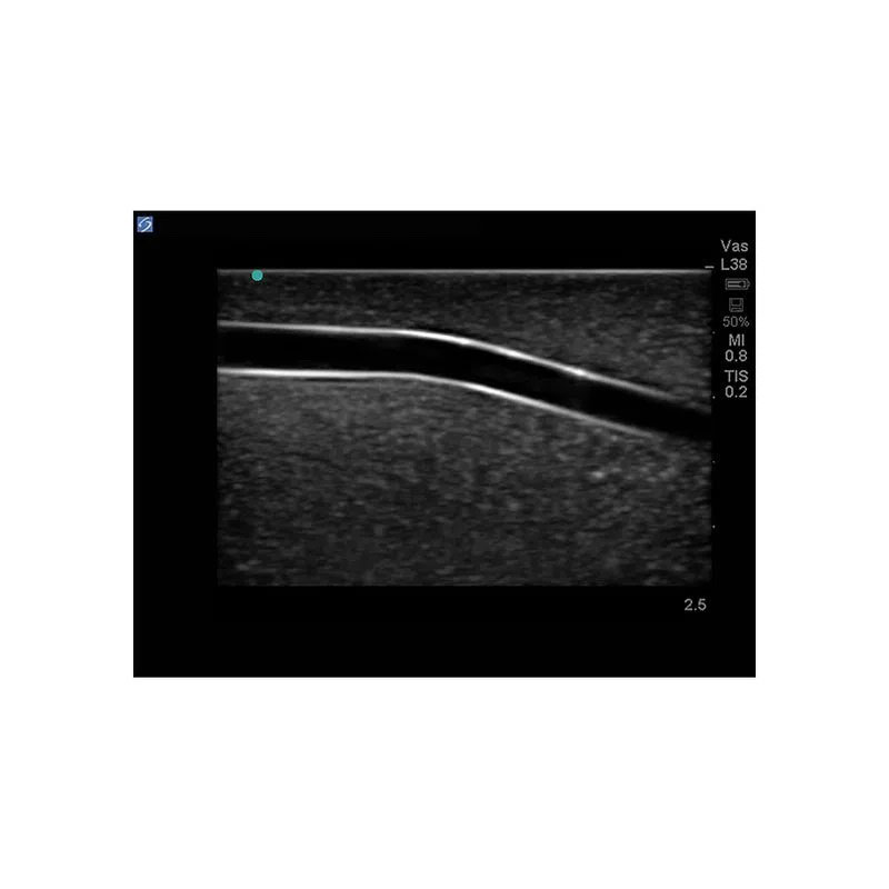 Leg Model With Femoral & Saphenous Vein Venous Access for Ultrasound ...