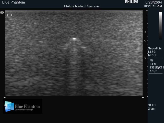 Leg With Foreign Body Identification Insert For Ultrasound Training, EX ...