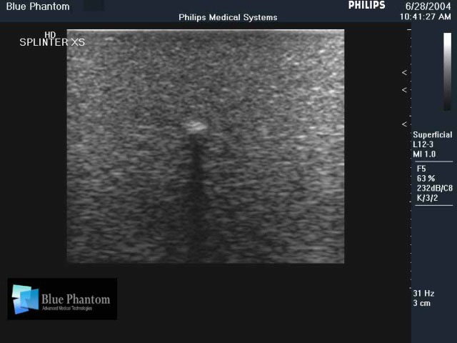 Leg With Foreign Body Identification Insert For Ultrasound Training, EX ...