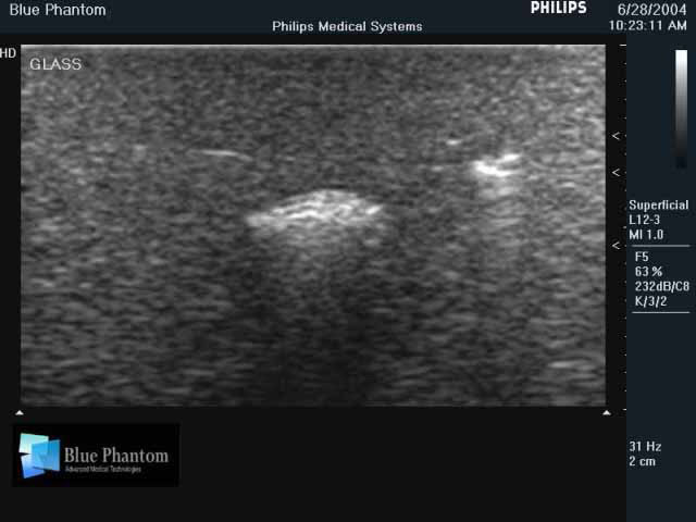 Leg With Foreign Body Identification Insert For Ultrasound Training, EX ...