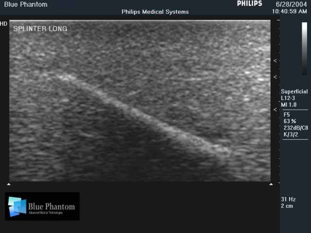 Leg With Foreign Body Identification Insert For Ultrasound Training, EX ...