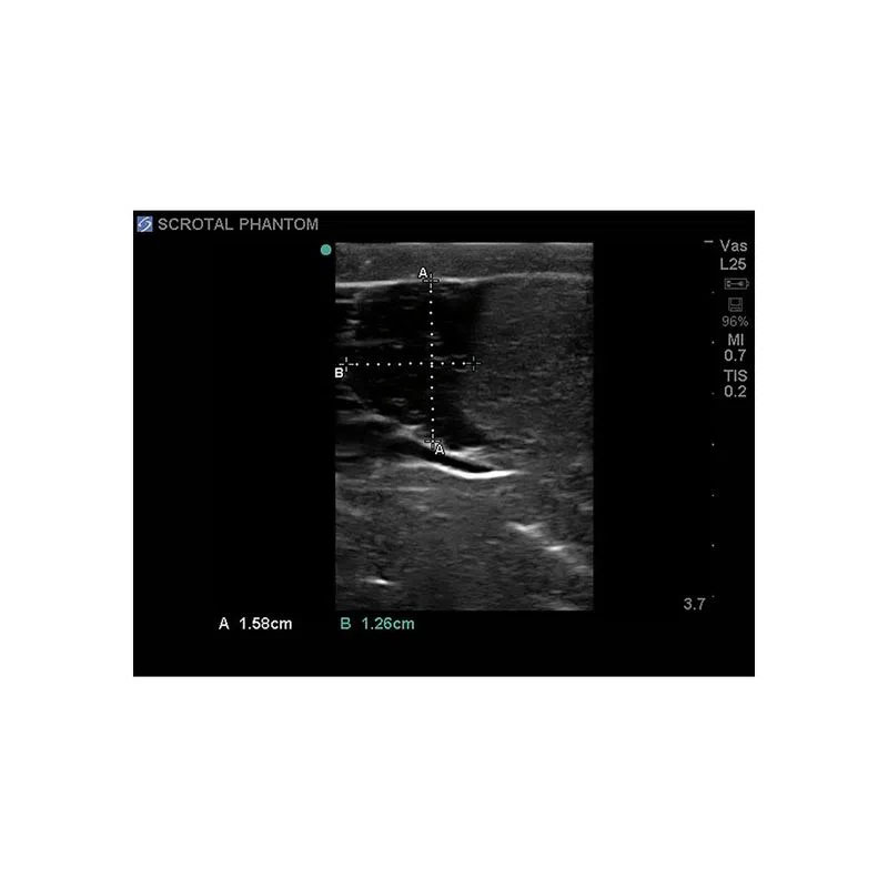 Scrotal Ultrasound Training Model | Adam,Rouilly