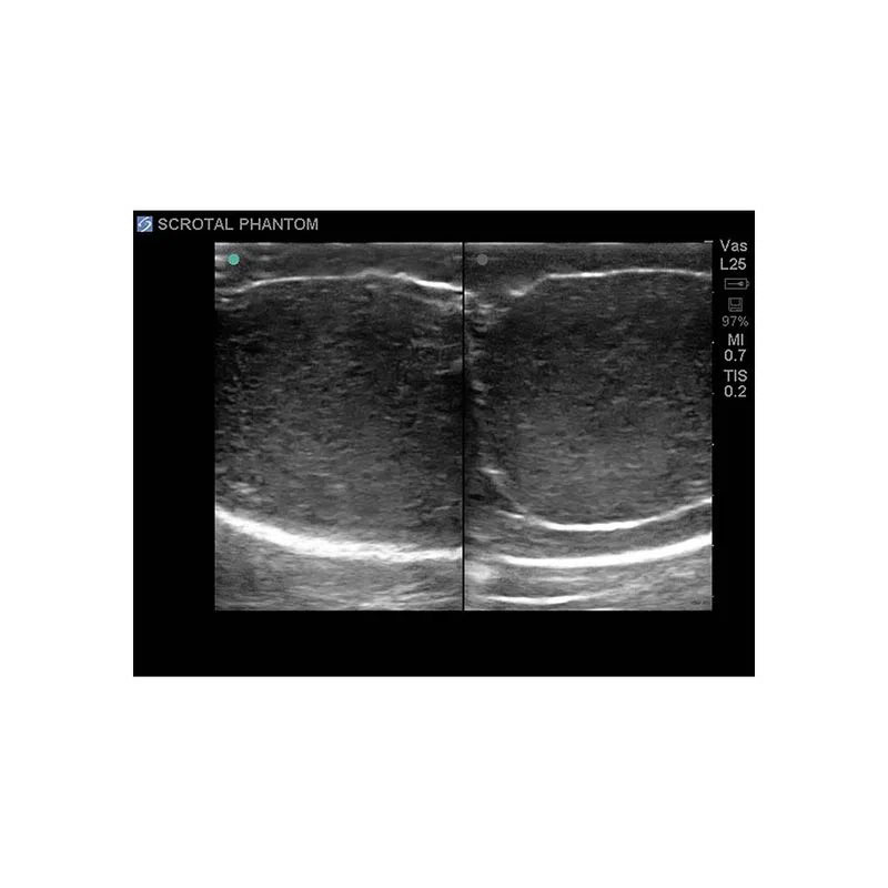 Scrotal Ultrasound Training Model | Adam,Rouilly