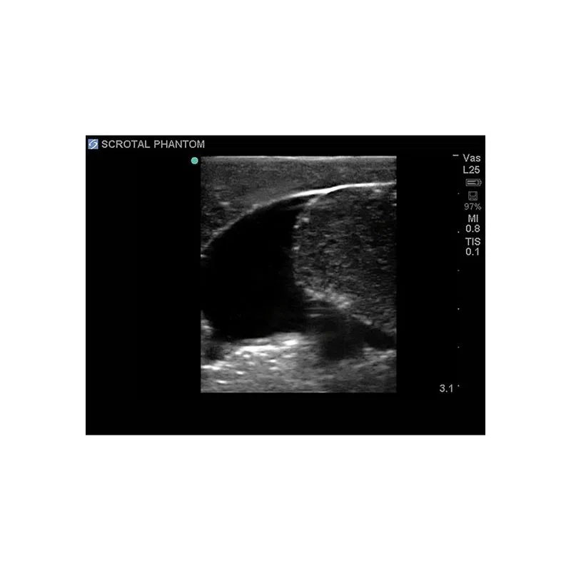 Scrotal Ultrasound Training Model | Adam,Rouilly