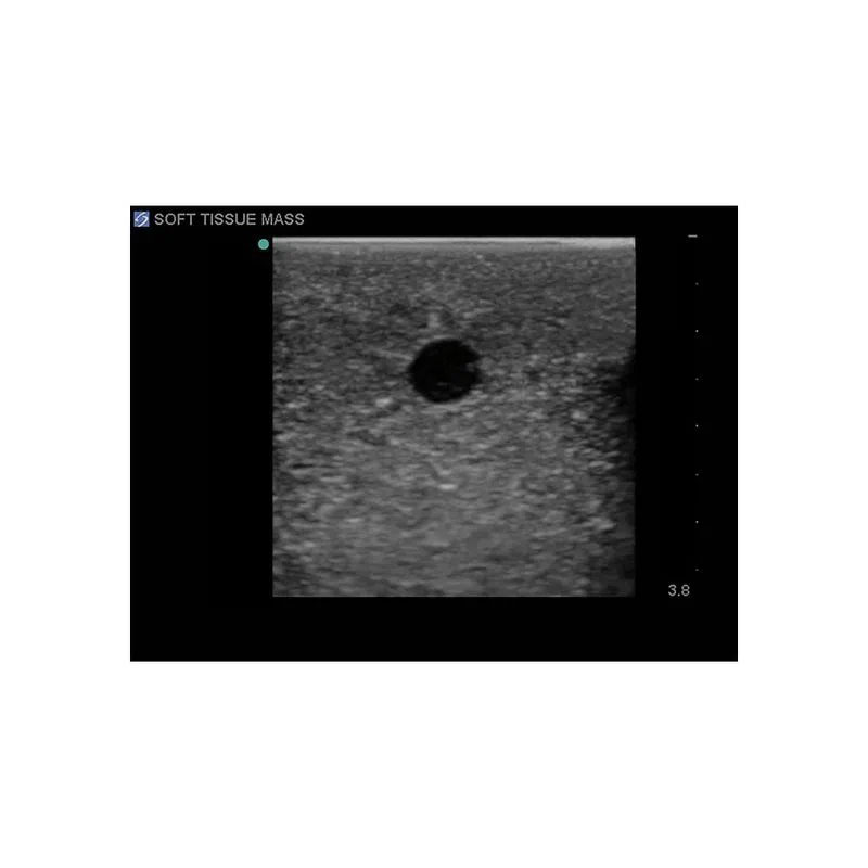 Breast Elastography Ultrasound Training Model | Adam,Rouilly