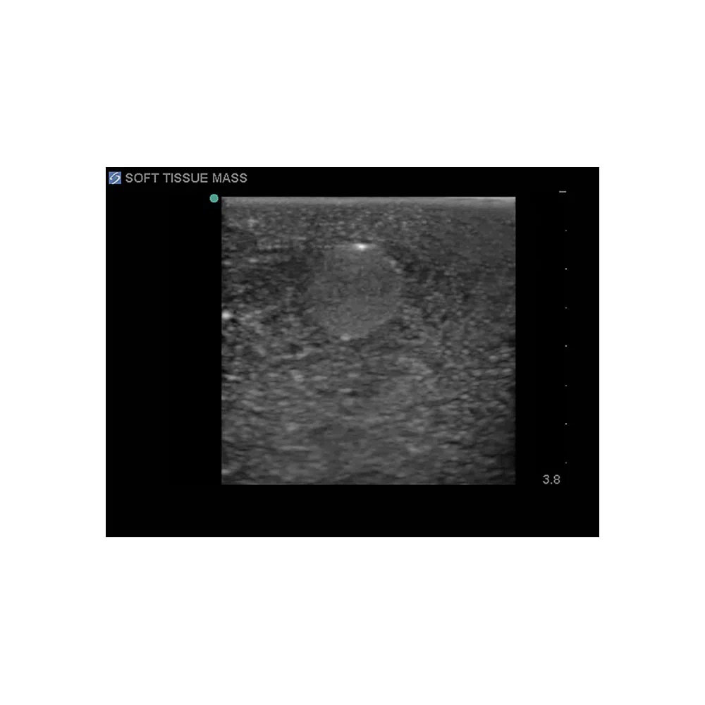 Breast Elastography Ultrasound Training Model | Adam,Rouilly