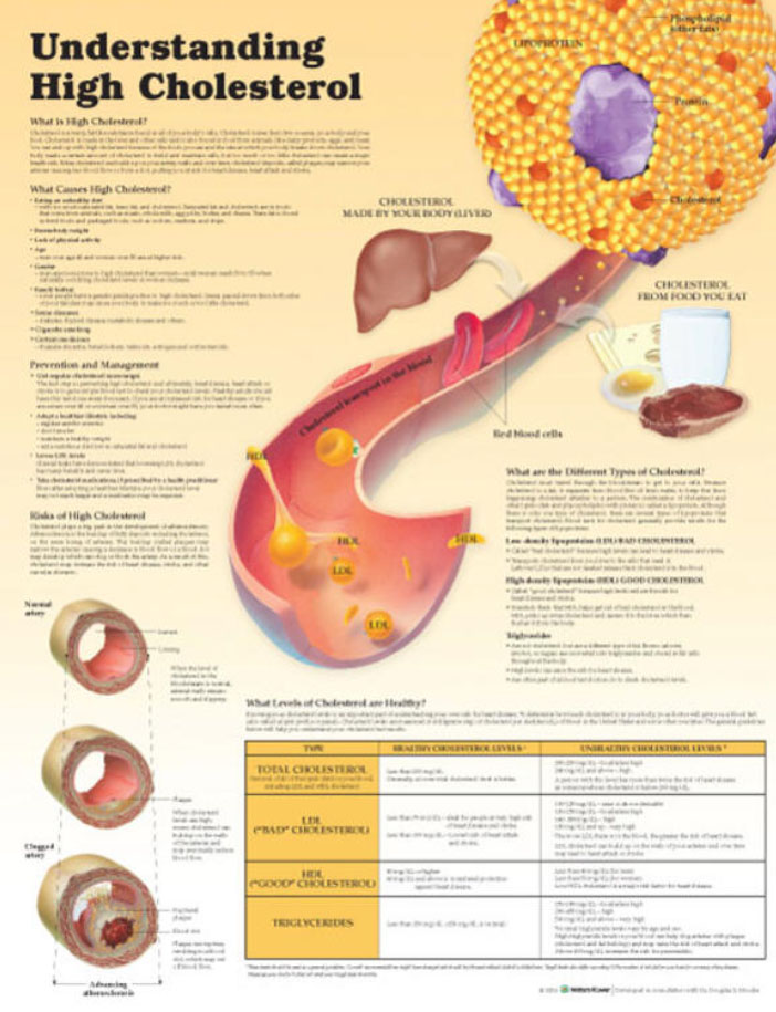 Understanding High Cholesterol | Adam,Rouilly