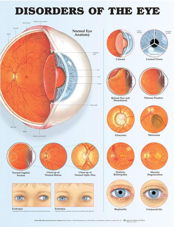 Disorders of the Eye Chart - Adam,Rouilly
