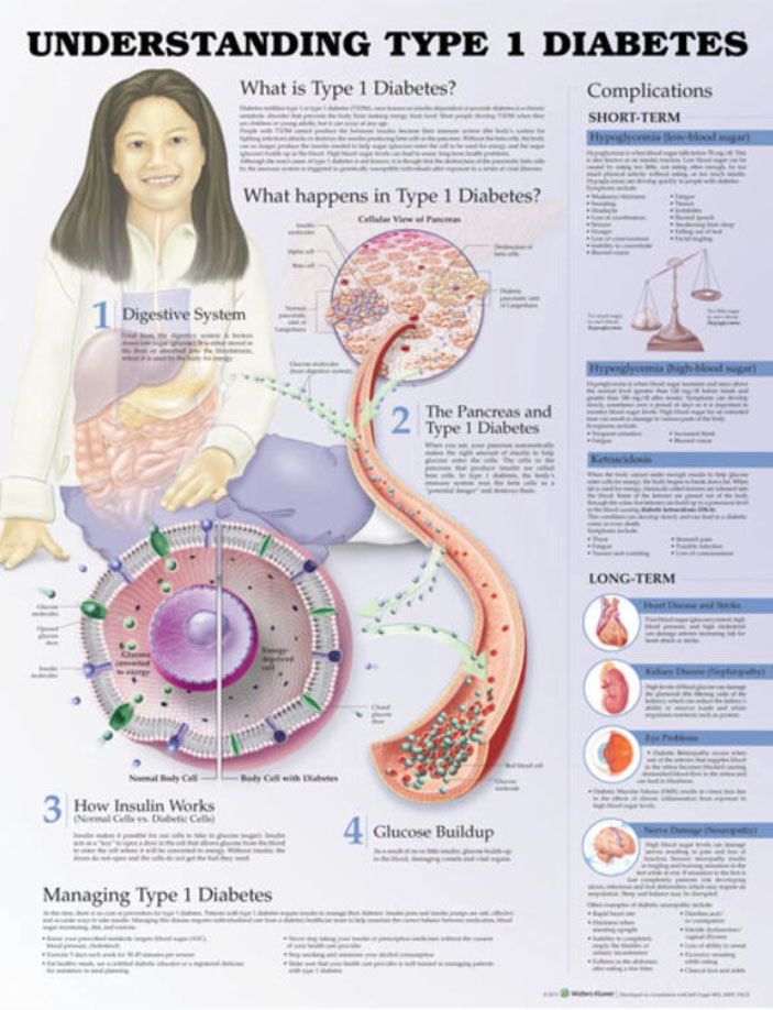 Understanding Type 1 Diabetes Chart - Adam,Rouilly