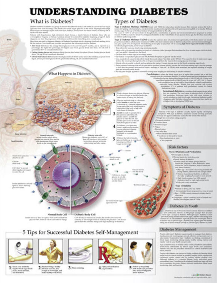 Understanding Diabetes Chart | Adam,Rouilly