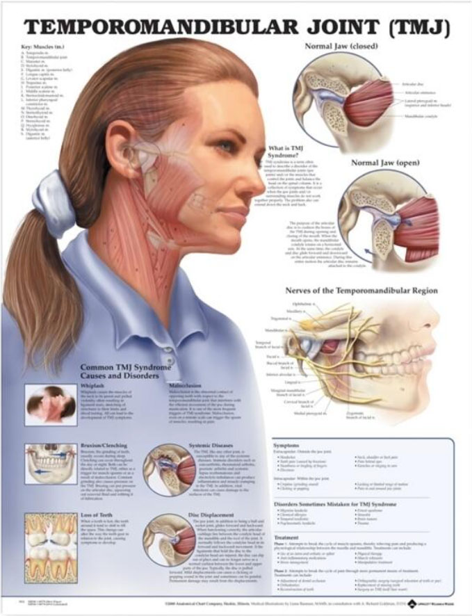 Temporomandibular Joint Syndrome Chart - Adam,Rouilly