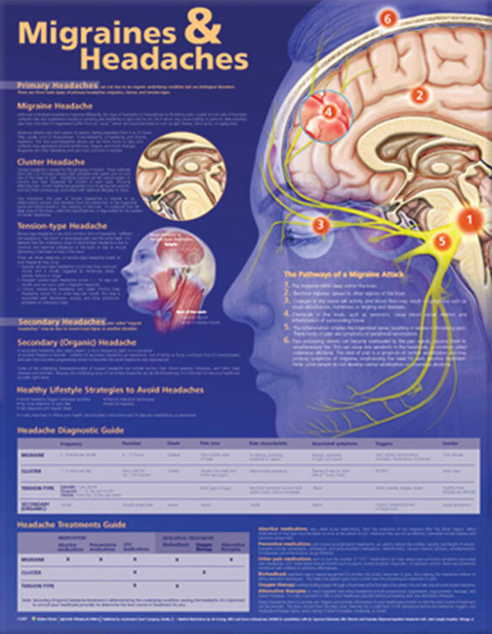 Migraines and Headaches Chart - Adam,Rouilly