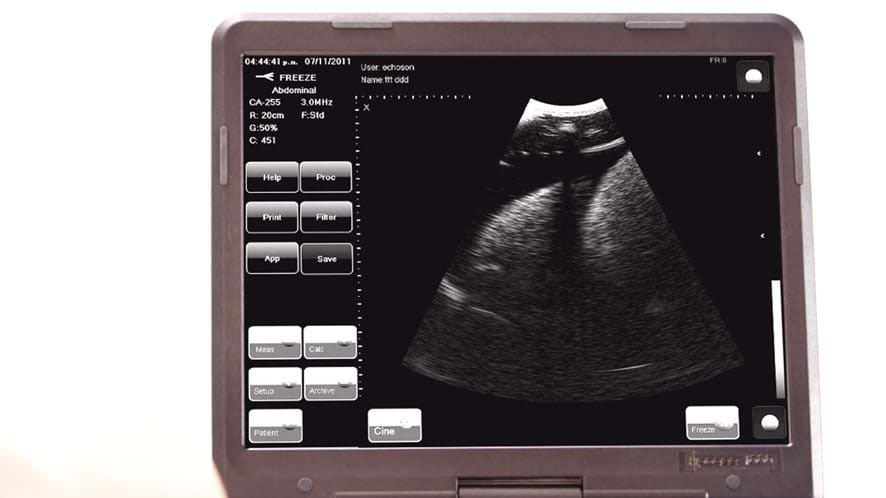 Chest Drain & Needle Decompression Trainer, Light - Adam,Rouilly