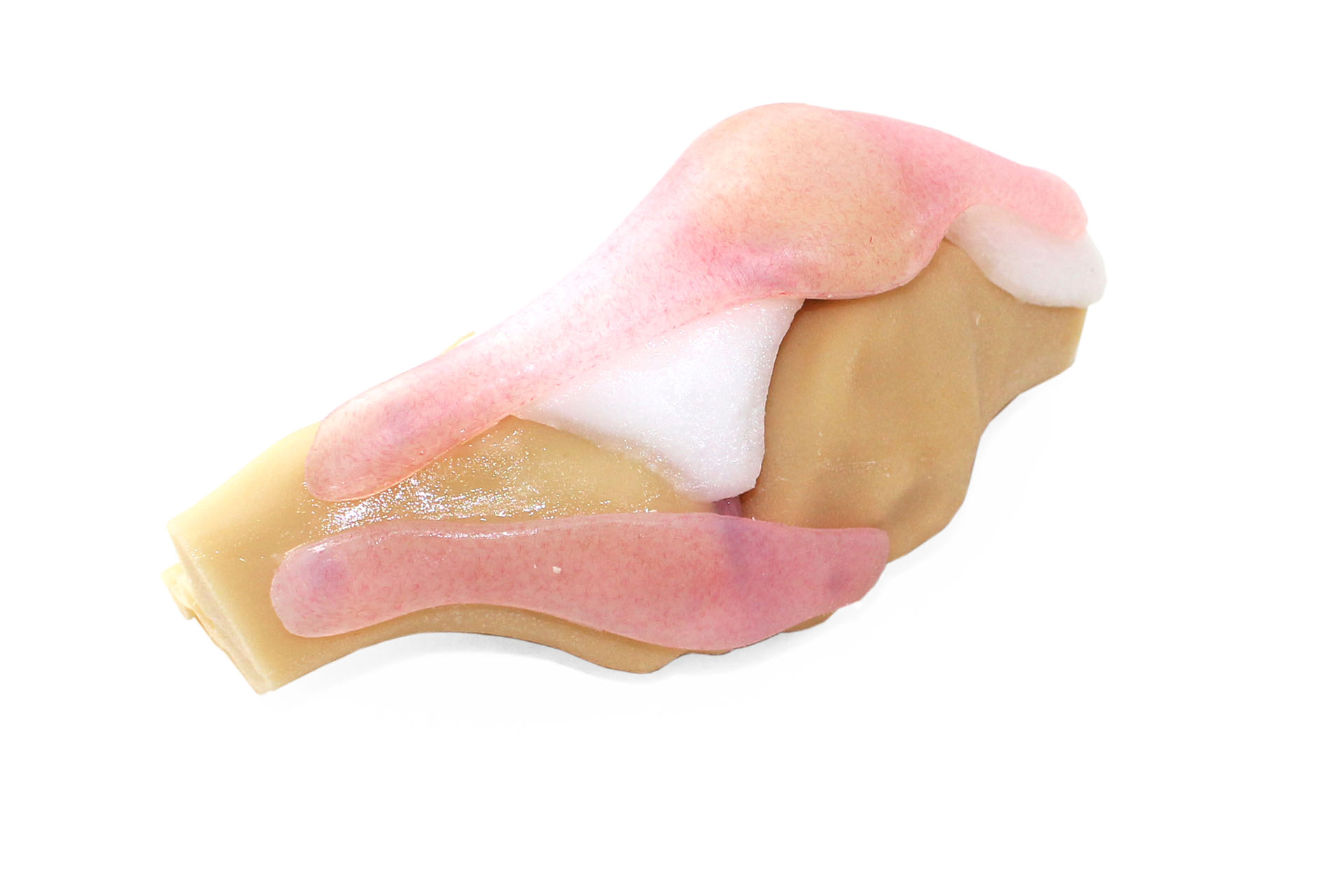 Limbs & Things Knee Aspiration & Injection Trainer With Ultrasound ...