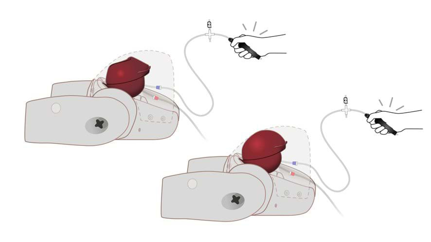 Prompt Flex Postpartum Haemorrhage Kit - Adam,Rouilly