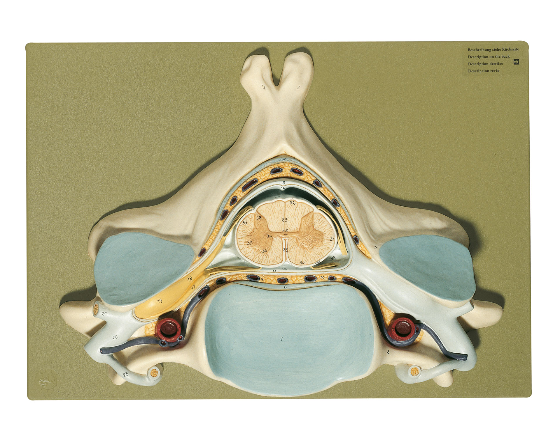 Fifth Cervical Vertebra - Adam,Rouilly