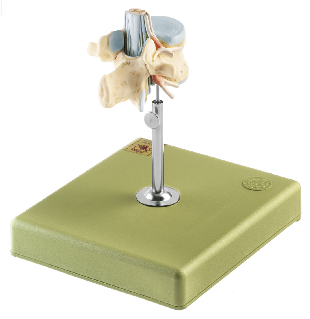 Lumbar Vertebra (L II) With Lumbar Region of Spinal Cord - Adam,Rouilly