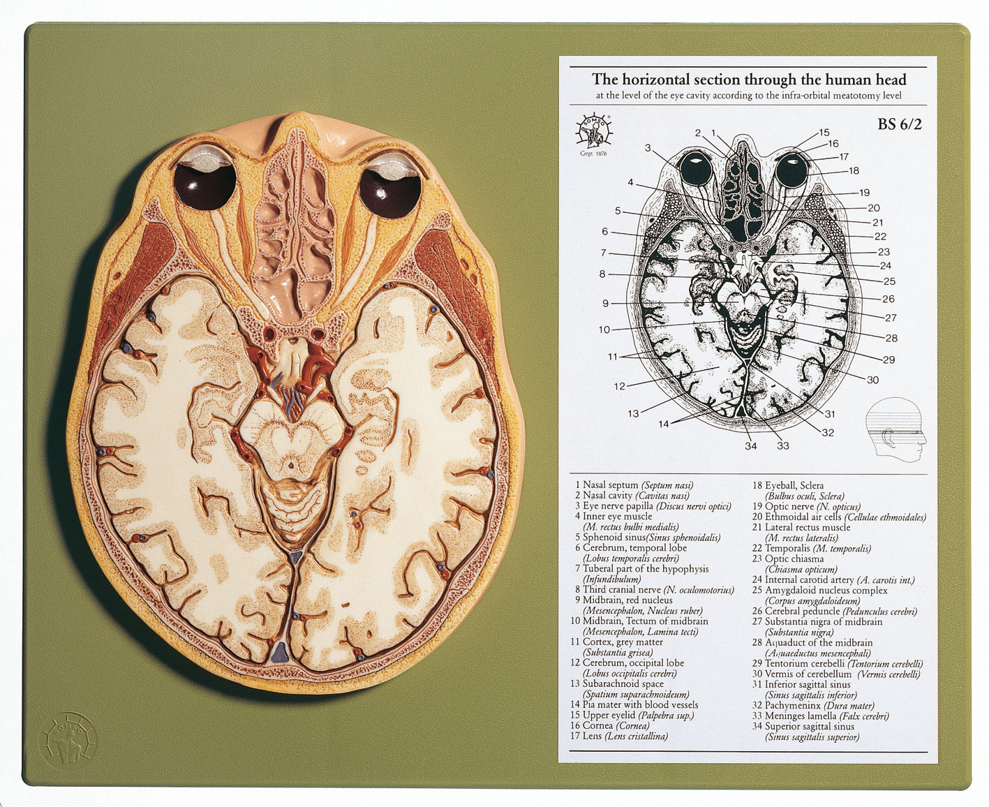 Horizontal Section of the Head at the Plane of the Orbit - Adam,Rouilly