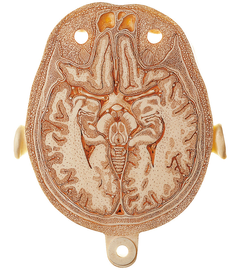 Anatomical Sectional Model of the Head (Combined With Corresponding Mr ...