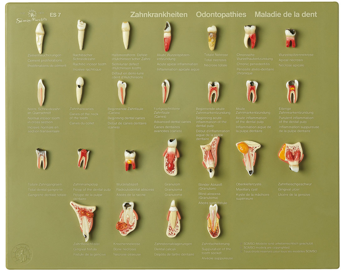 Case of Teeth "Odontopathies" - Adam,Rouilly