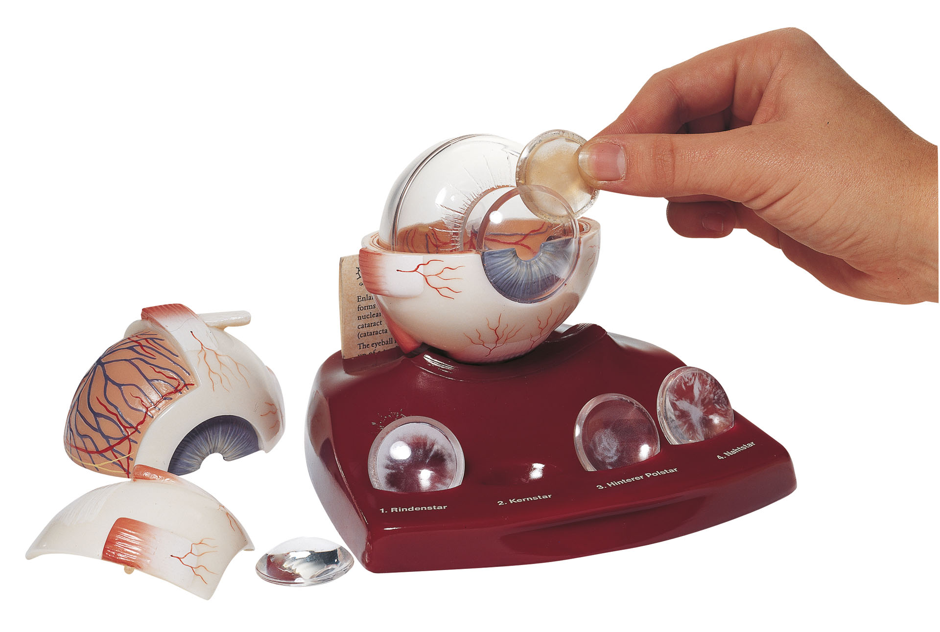 Cataract Eye Model - Adam,Rouilly