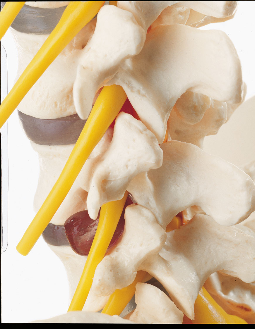 Vertebral Column With Pelvis - Adam,Rouilly