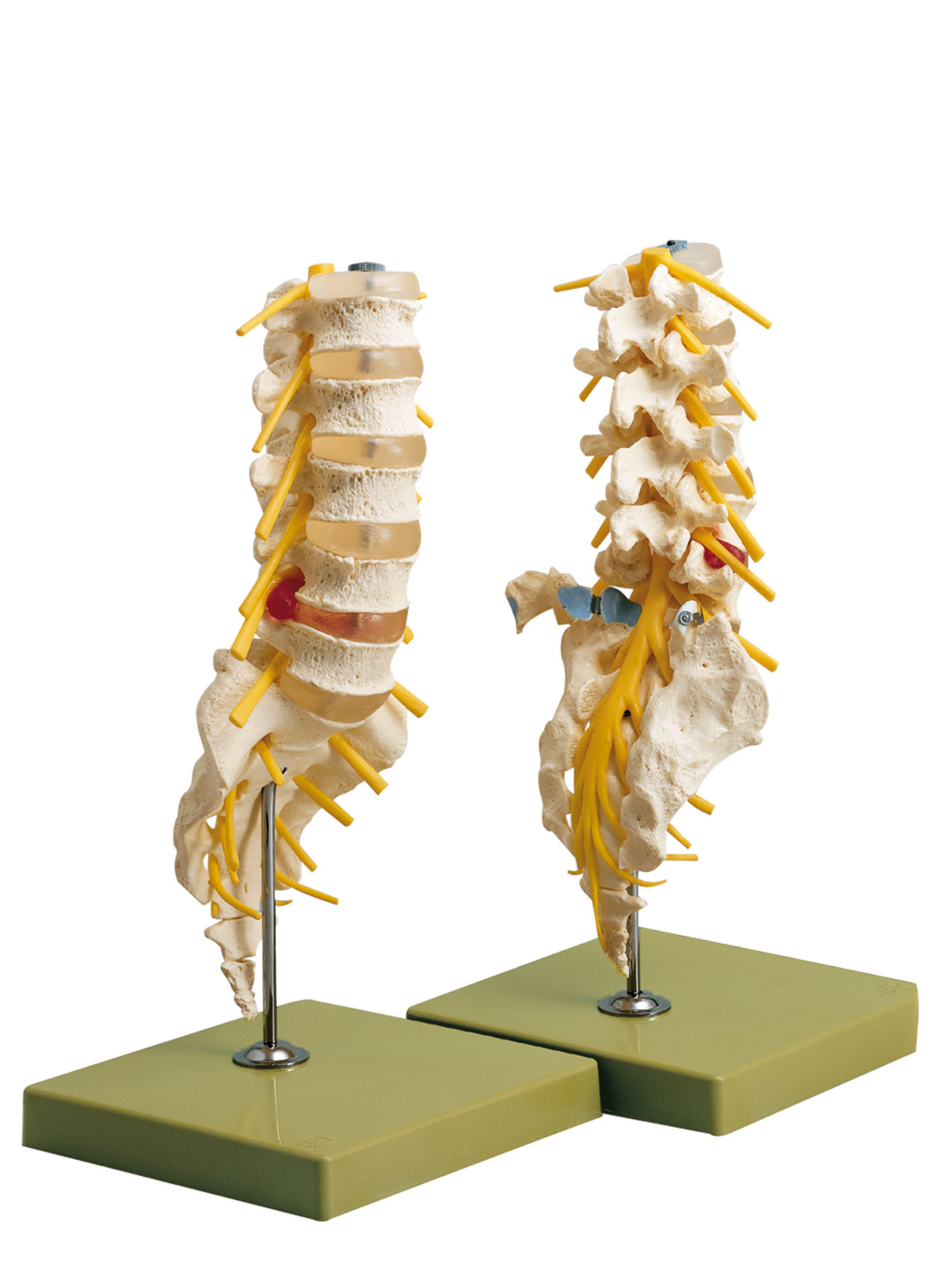 Lumbar Vertebral Column - Adam,Rouilly