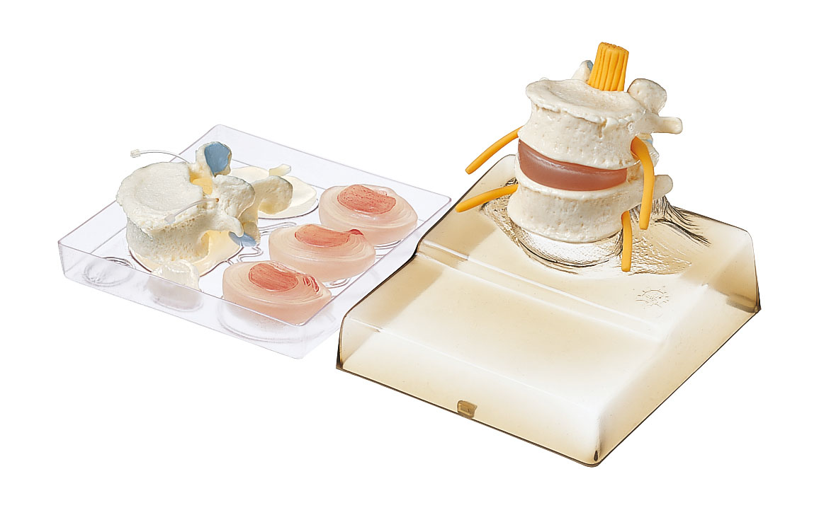 Intervertebral Disc Model | Adam,Rouilly