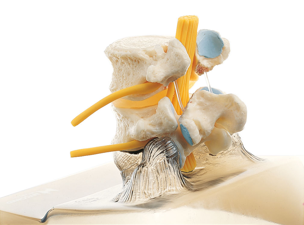 Intervertebral Disc Model | Adam,Rouilly