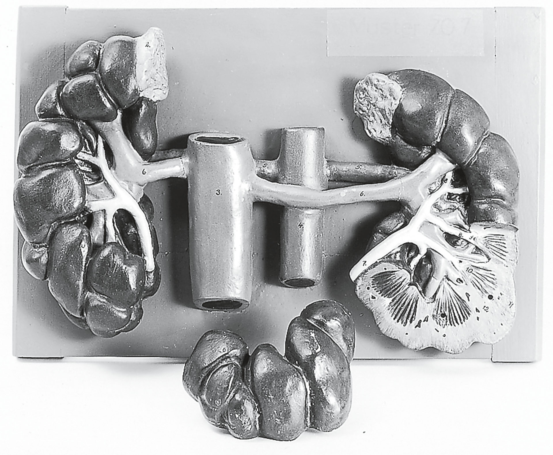 Kidneys of the Cow - Adam,Rouilly