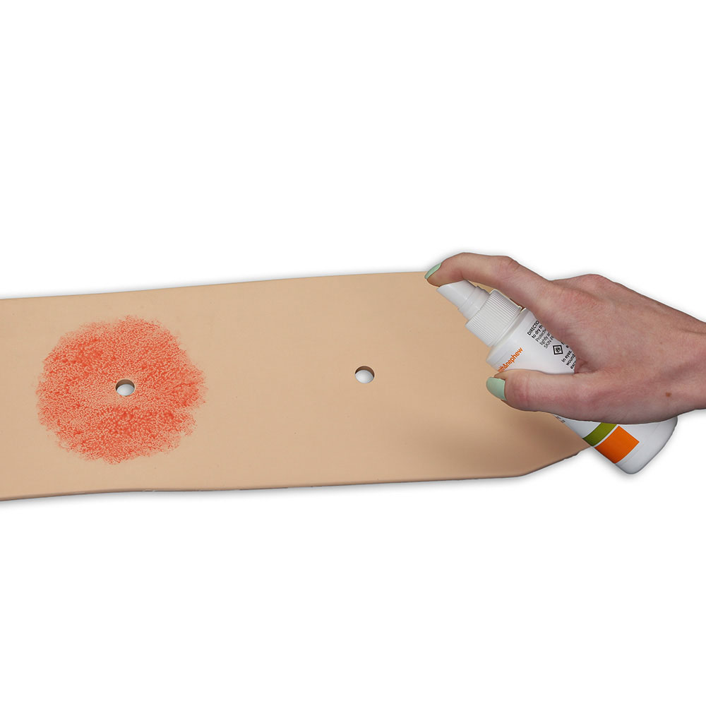 Ostomy Pouching Trainer™ Model - Adam,Rouilly