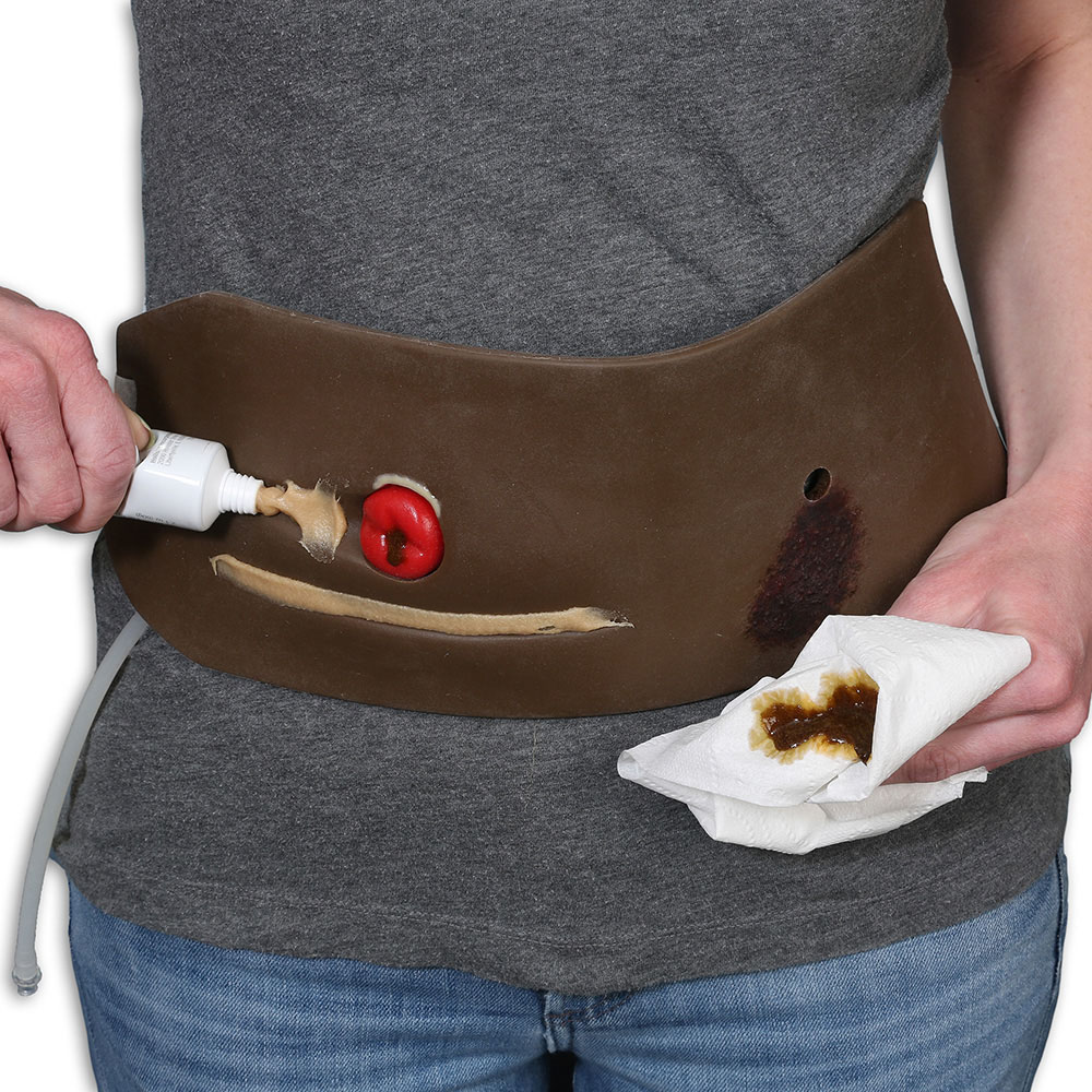 Ostomy Pouching Trainer™ Model - Adam,Rouilly