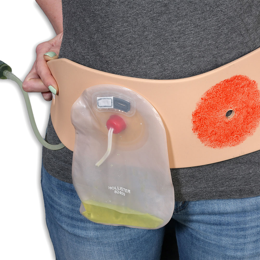 Ostomy Pouching Trainer™ Model - Adam,Rouilly