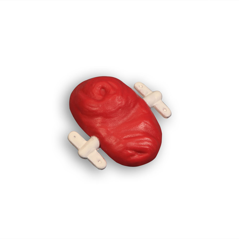 Loop Stoma With Rod - Adam,Rouilly