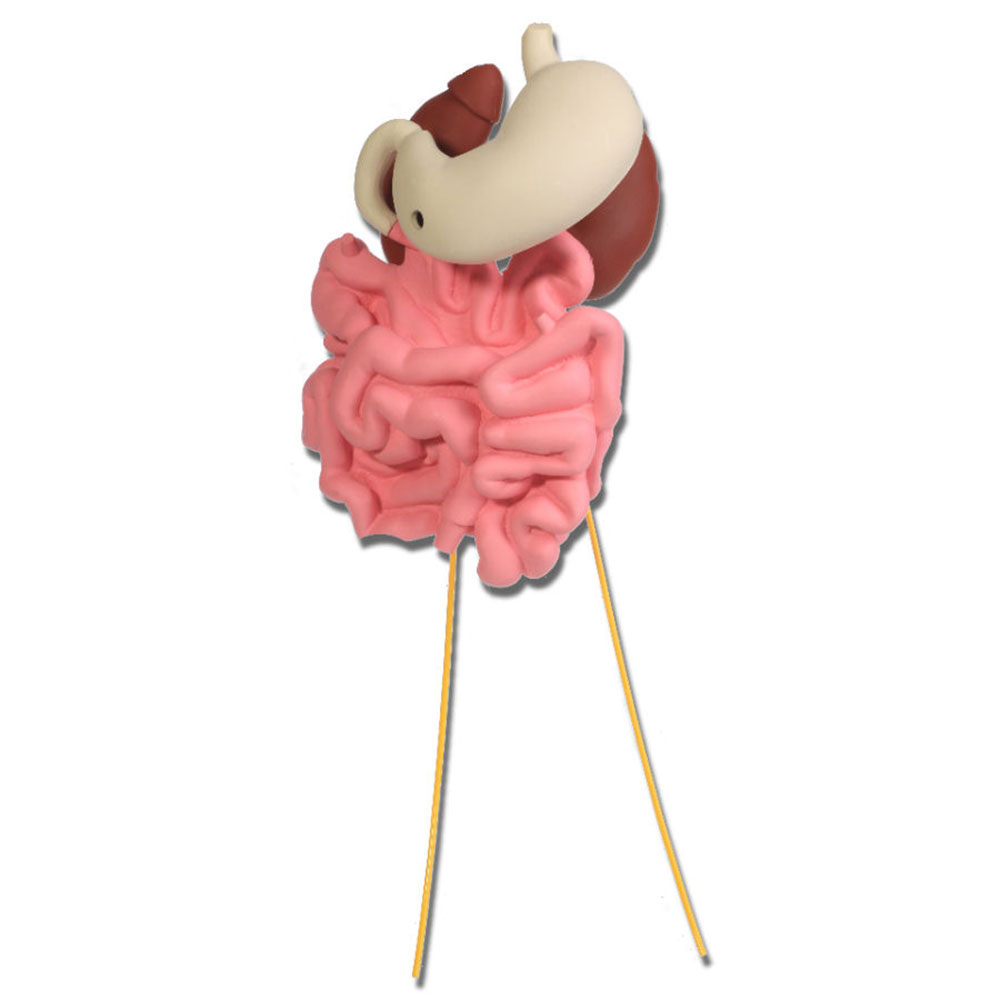 Replacement Small Intestine, Stomach, Right Kidney With Ureter & Left ...