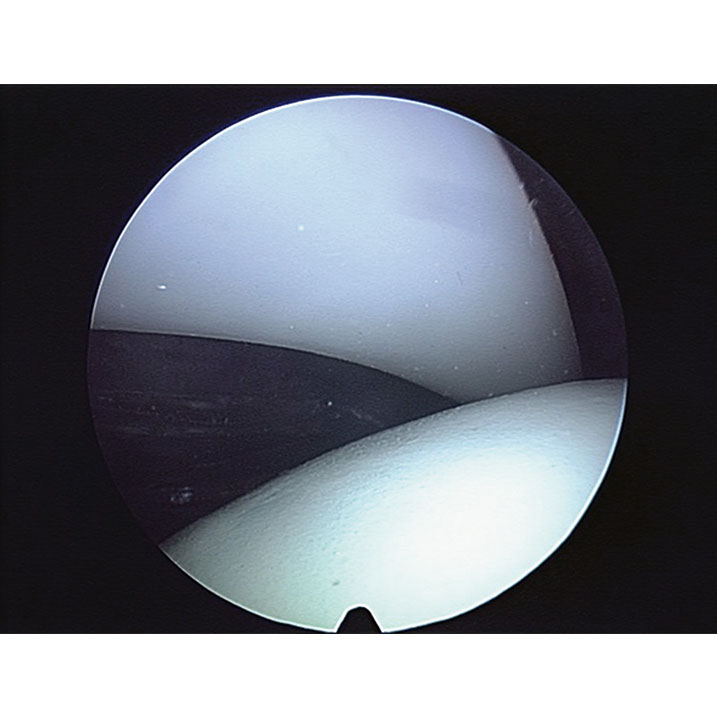 Arthroscopy Model of the Shoulder - Adam,Rouilly