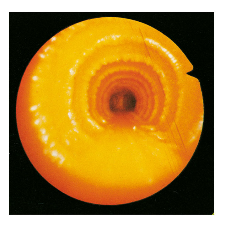 Scopin II (Broncho Boy) Trainer - Adam,Rouilly