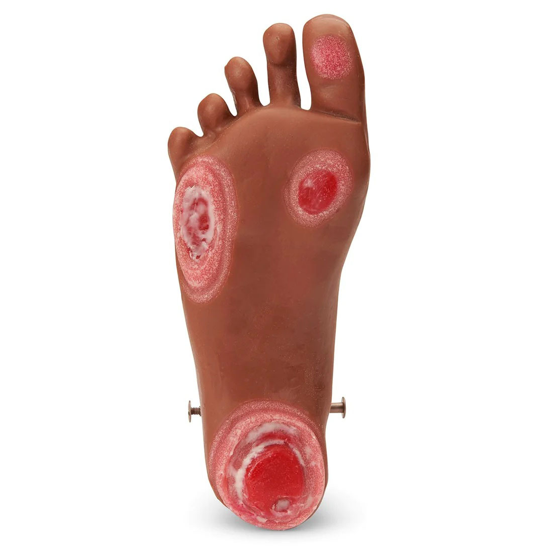 Geri™ and Keri™ Optional Pressure Injury Foot - Adam,Rouilly