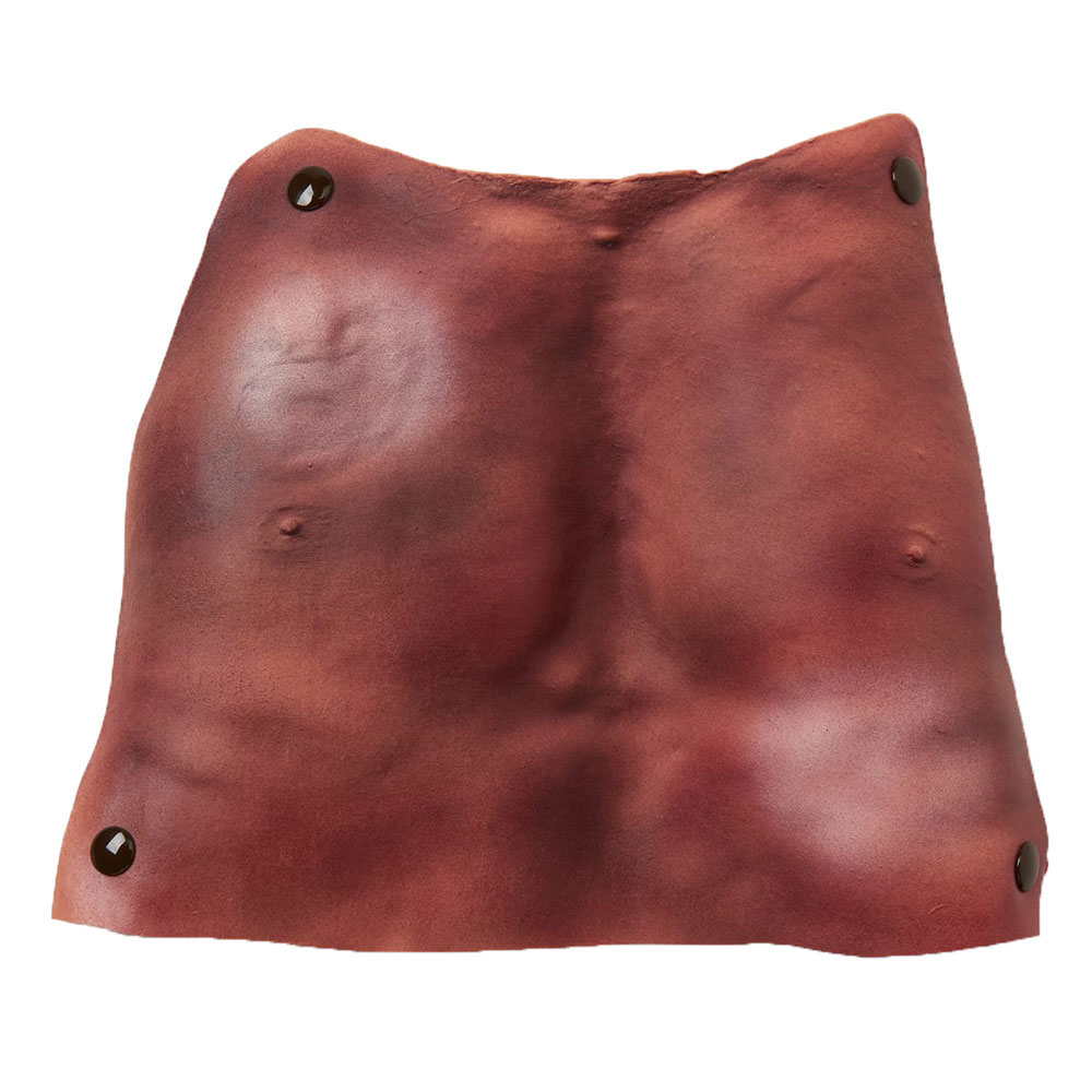 2nd and 3rd Degree Burn of Chest - Adam,Rouilly