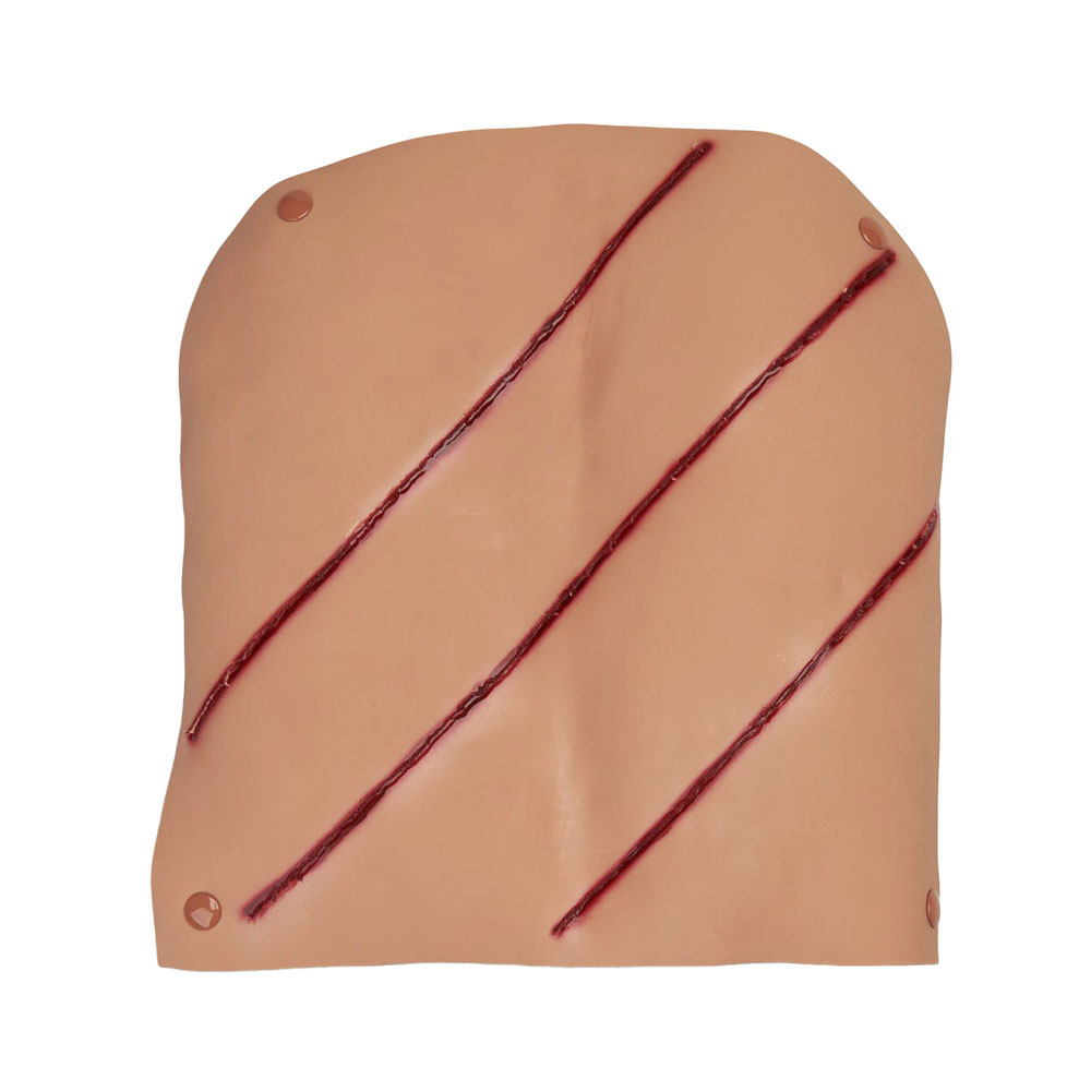 Blade/Propeller Wound - Adam,Rouilly