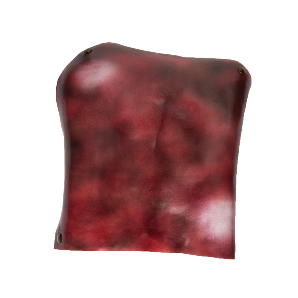 2nd and 3rd Degree Burn of Back - Adam,Rouilly