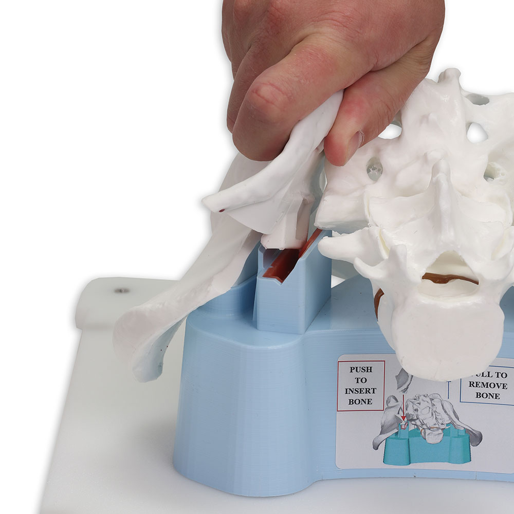 Bonnie Bone Marrow Biopsy Skills Trainer | Adam,Rouilly